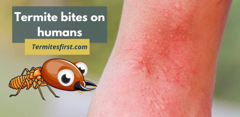 Termite Bites on Humans: Risks and Prevention Explained – Termites First